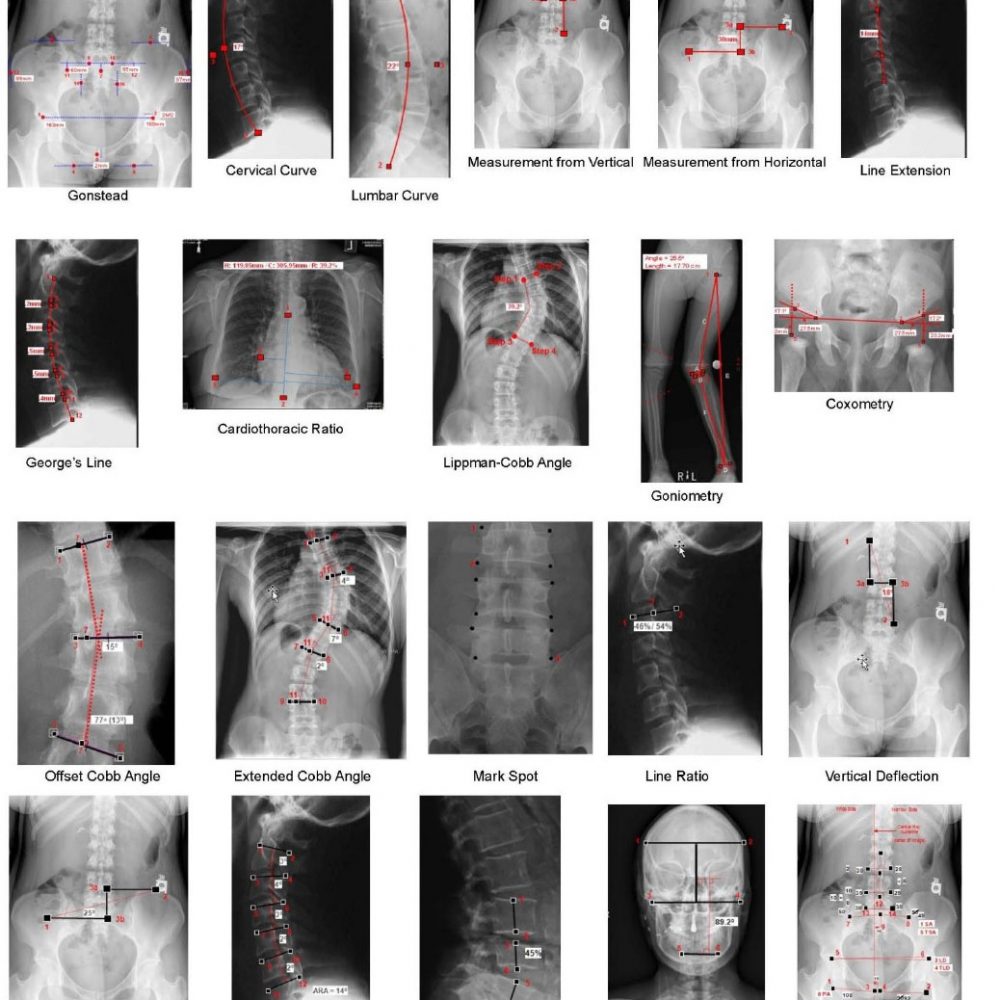 Detectores inalámbricos DRX Core 3543 – Primera Medical